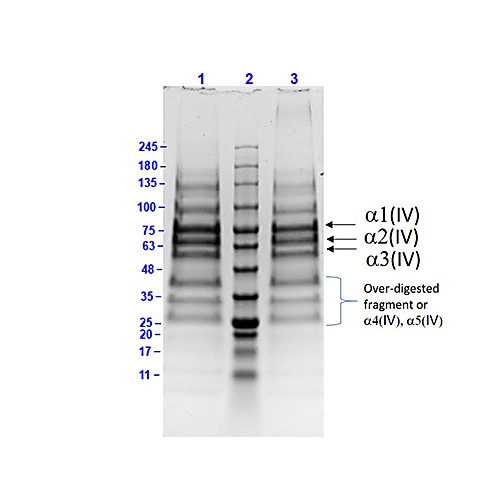 Human COLLAGEN Type IV, 500µg