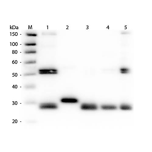 Anti-RAT IgG (H&L) (RABBIT) Antibody Rhodamine Conjugated (Min X Human ...