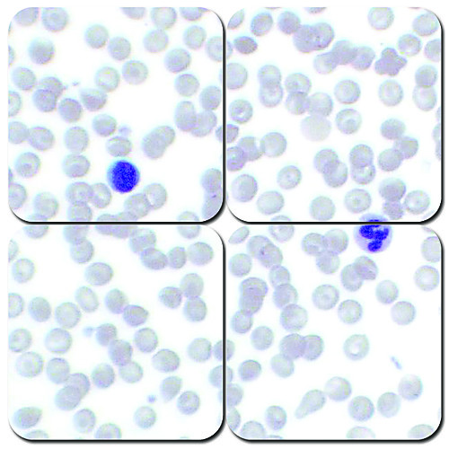 Wright-Giemsa Stain Kit, Pint