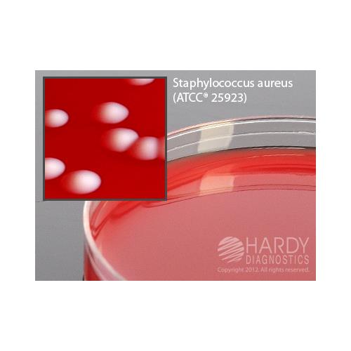 Columbia Blood Agar with 5% Sheep Blood
