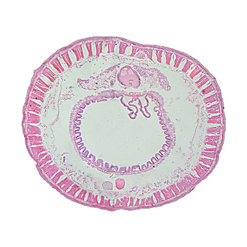 Prepared Microscope Slide,Histology; Earthworm Nephridium W.M.