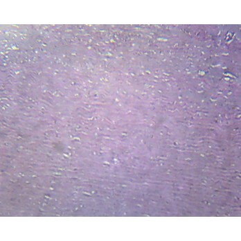 Prepared Microscope Slide,Atherosclerosis Human Coronary Artery