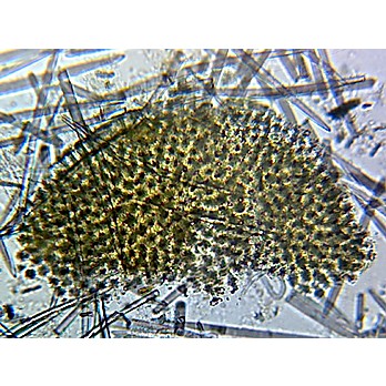 Prepared Microscope Slide, Zoology; Mixed Spicules W.M.