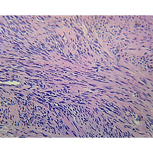 Prepared Microscope Slide, Histology; Uterus Section, Human Showing ...