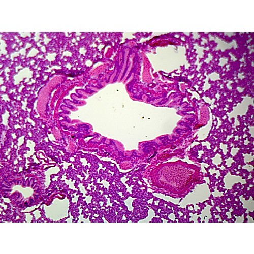 Prepared Microscope Slide,Lung Section