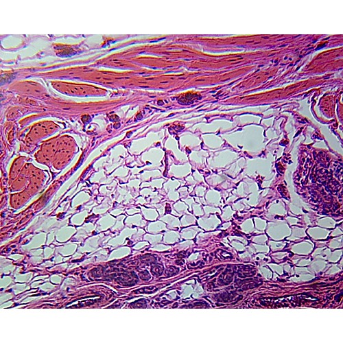 Prepared Microscope Slide,Integumentary Tissues, Human Skin, C.S.