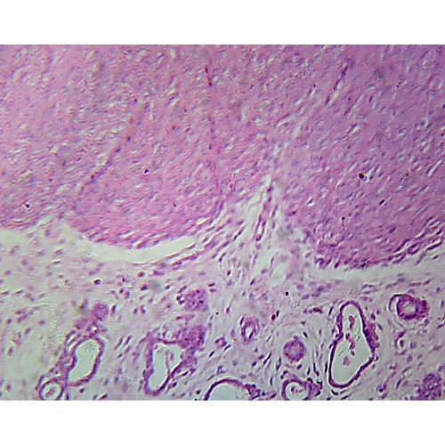 Prepared Microscope Slide,Female Cervix Uteri, Columnar Epithelium