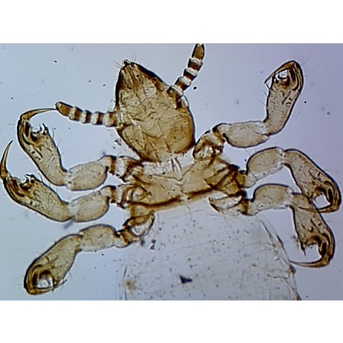 Prepared Microscope Slide,Pediculus Humanus Capitis Female W.M.