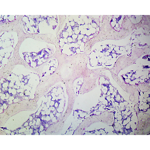 Prepared Microscope Slide,Histology; Spongy Bone Section Mammal