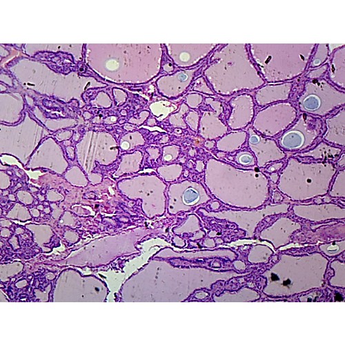 Prepared Microscope Slide,Goiter Human Thyroid Gland