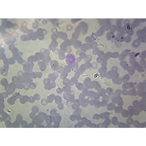 Prepared Microscope Slide,Balantidium Coli Trophozoites Spirotrich