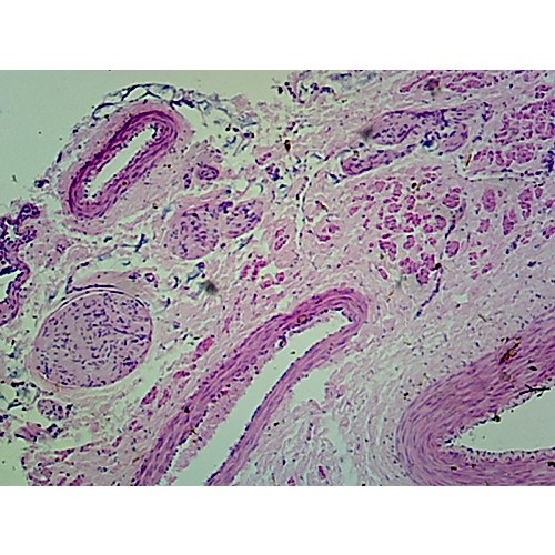 Prepared Microscope Slide Medium Sized Artery And Vein C S Human