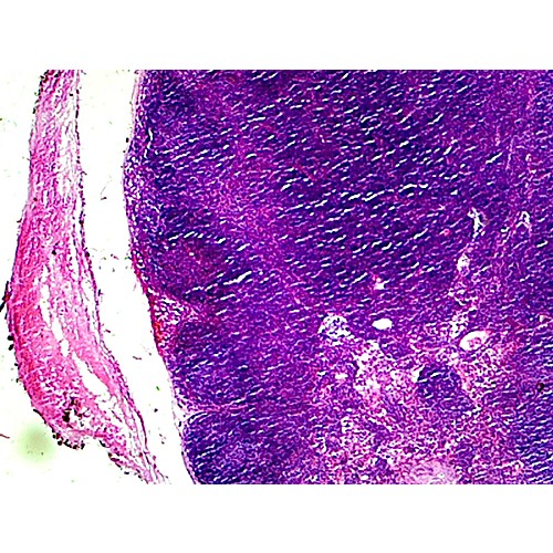 Prepared Microscope Slide,Histology; Lymph Node Section. Mammal