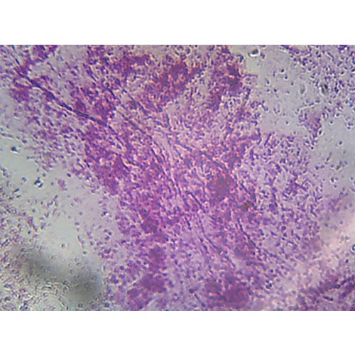 Prepared Microscope Slide,Pseudomonas Aeruginosa Smear