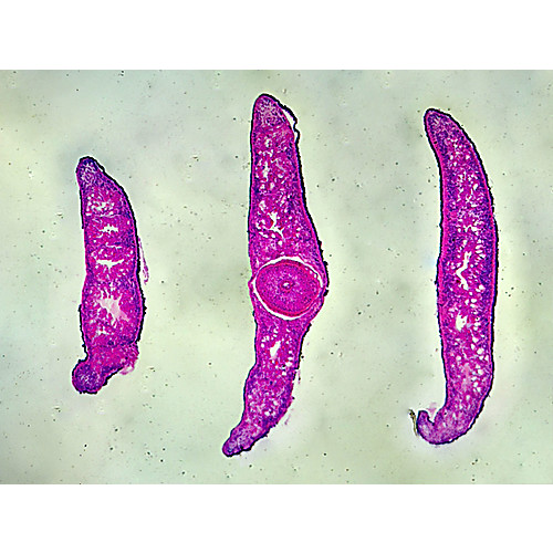 Prepared Microscope Slide,Planaria, Three Different Regions; Cross Section, Showing Anterior ...