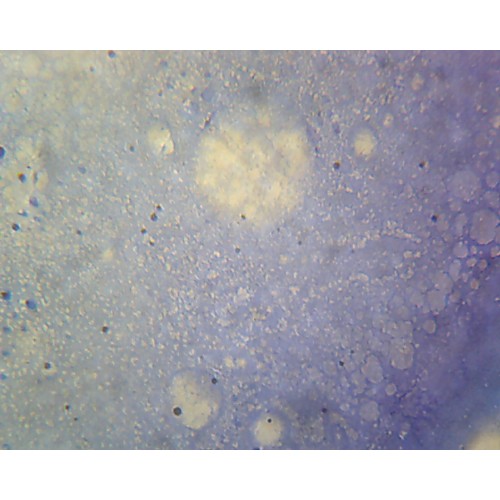 Prepared Microscope Slide,Mycobacterium Tuberculosis, Smear