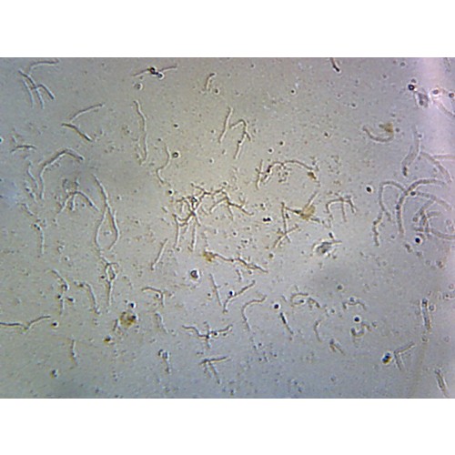 Prepared Microscope Slide,Leptospira Smear