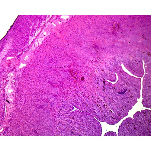Prepared Microscope Slide,Female Uterus Section, Human