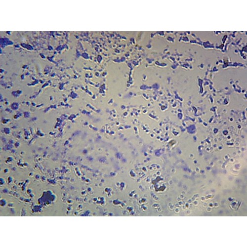 Prepared Microscope Slide,Clostridium Tetani, Agent of Tetanus