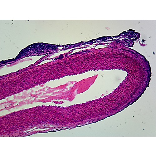 Prepared Microscope Slide, Large Sized Vein, C.S. Human Vena Cava