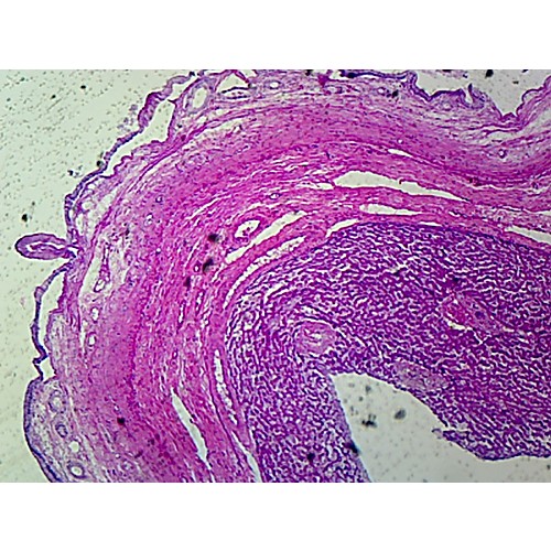 Prepared Microscope Slide,Gallbladder, Section, Human, Showing Simple ...