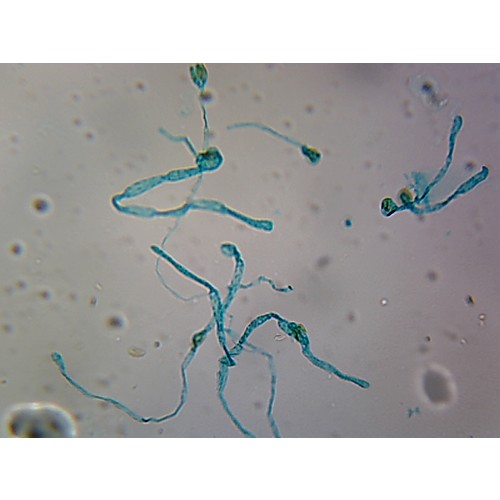 Prepared Microscope Slide,Moss Protonema, W.M.