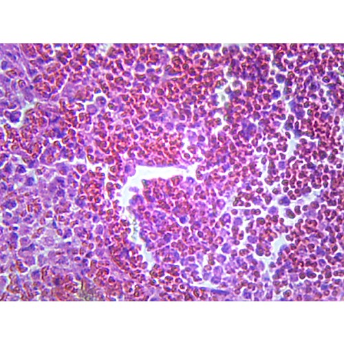 Prepared Microscope Slide,Pneumonia Section Human