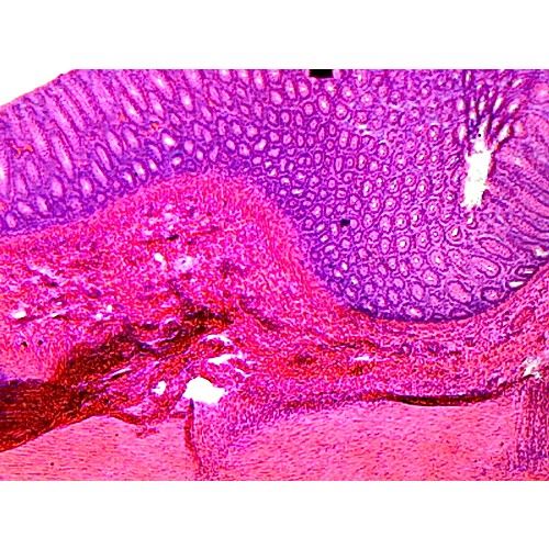 Prepared Microscope Slide,Colon; C.S. Mammal