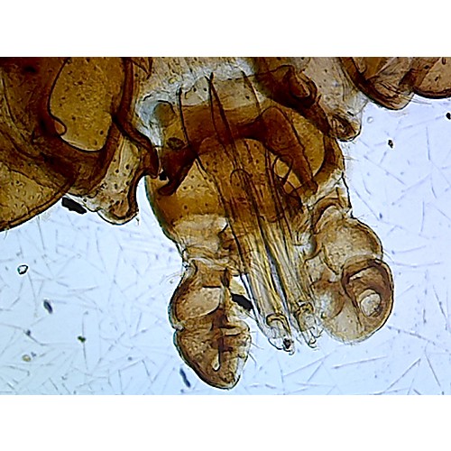 Prepared Microscope Slide,Histology; Tick, W.M.
