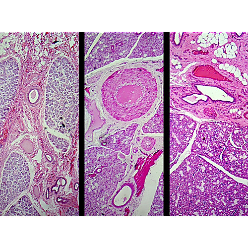 Prepared Microscope Slide,Salivary Glands, Submaxillary Parotid