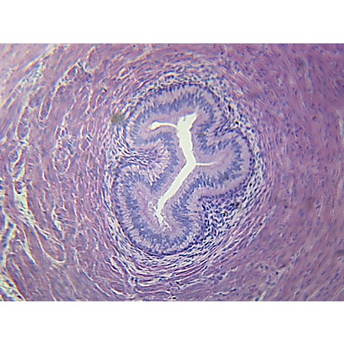 Prepared Microscope Slide,Excretory System; Ureter; C.S.