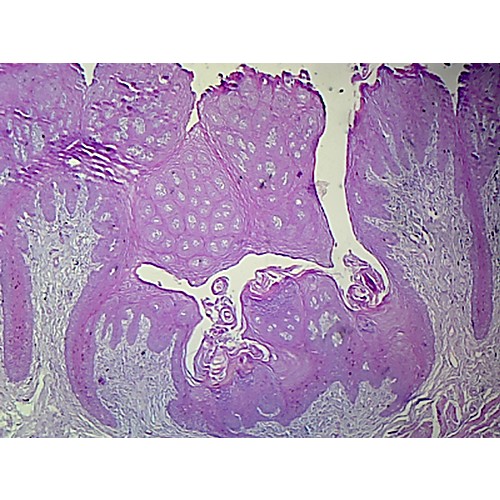 Prepared Microscope Slide,Tongue, C.S. Human