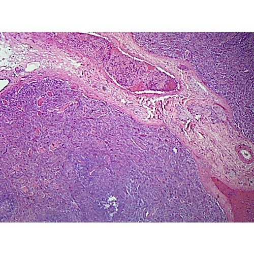 Prepared Microscope Slide,Histology; Spleen Sec., H&E Stain, Human