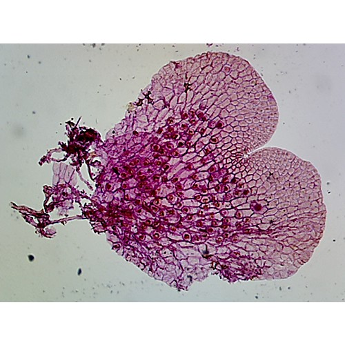 Prepared Microscope Slide,Pteridophyta Gametophytes Prothallium